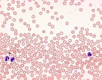 Hemacolor® Rapid staining of blood smear | 111661